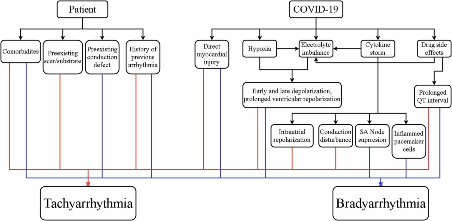 Review Article: Cardiac Arrhythmia among Hospitalized COVID-19 Patients ...